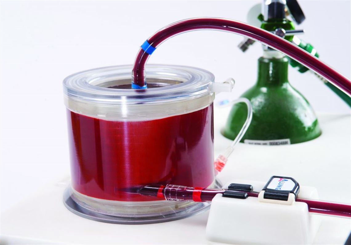 Coda for a storied Pittsburgh biotech: Hemolung production to end ...